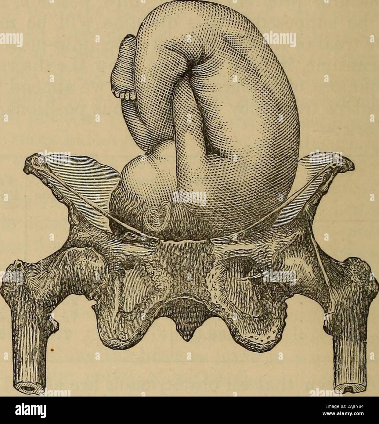 Faecal matter hi-res stock photography and images - Alamy