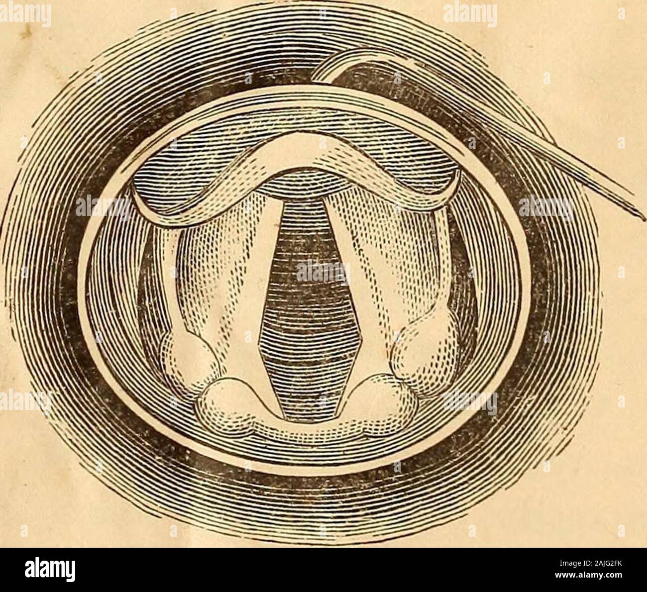 True vocal cords hi-res stock photography and images - Alamy