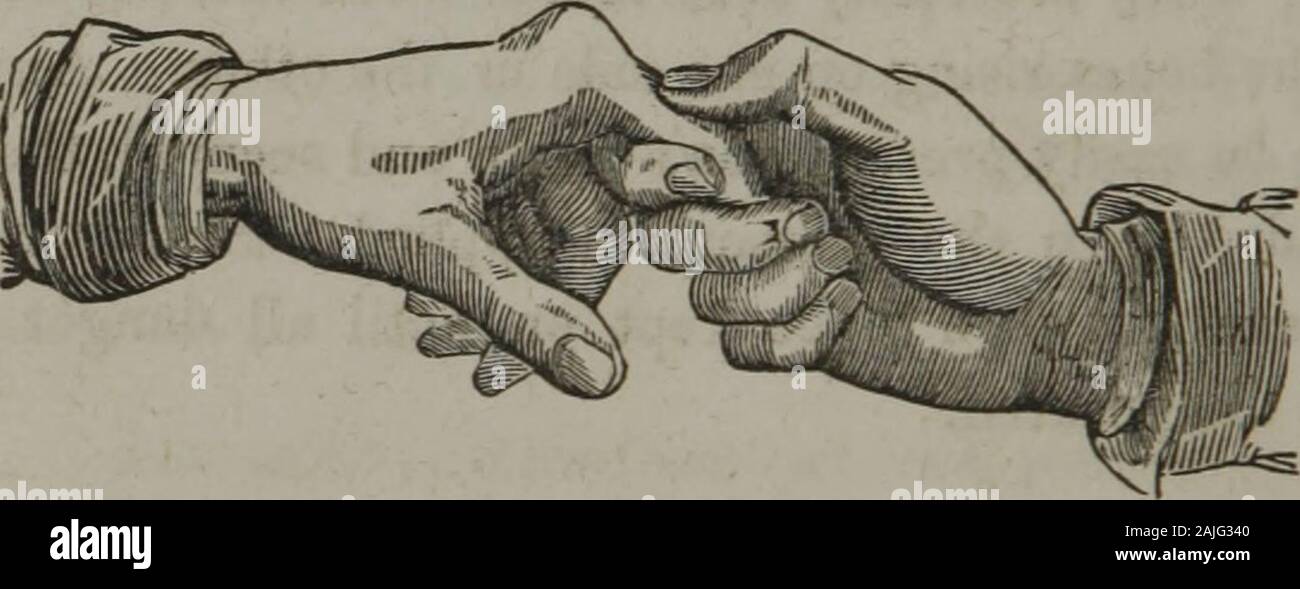 Dislocated finger hi-res stock photography and images - Alamy