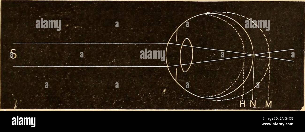 Inverted image in lens hi-res stock photography and images - Alamy