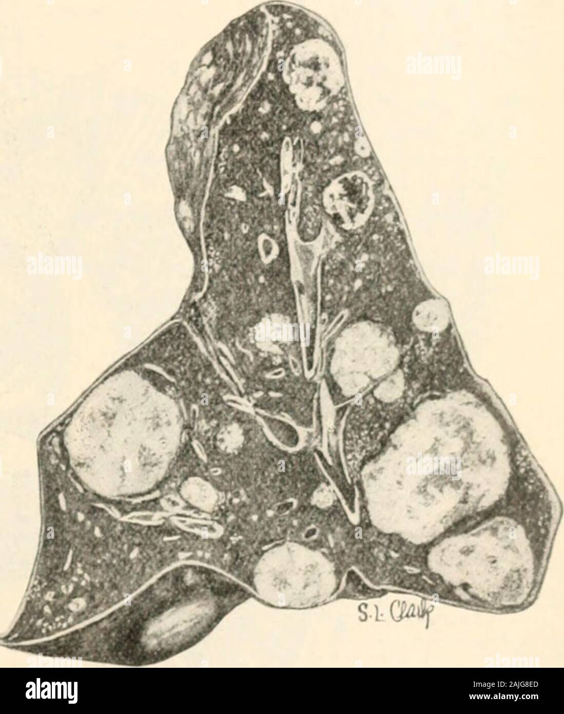 Manual of pathology : including bacteriology, the technic of ...