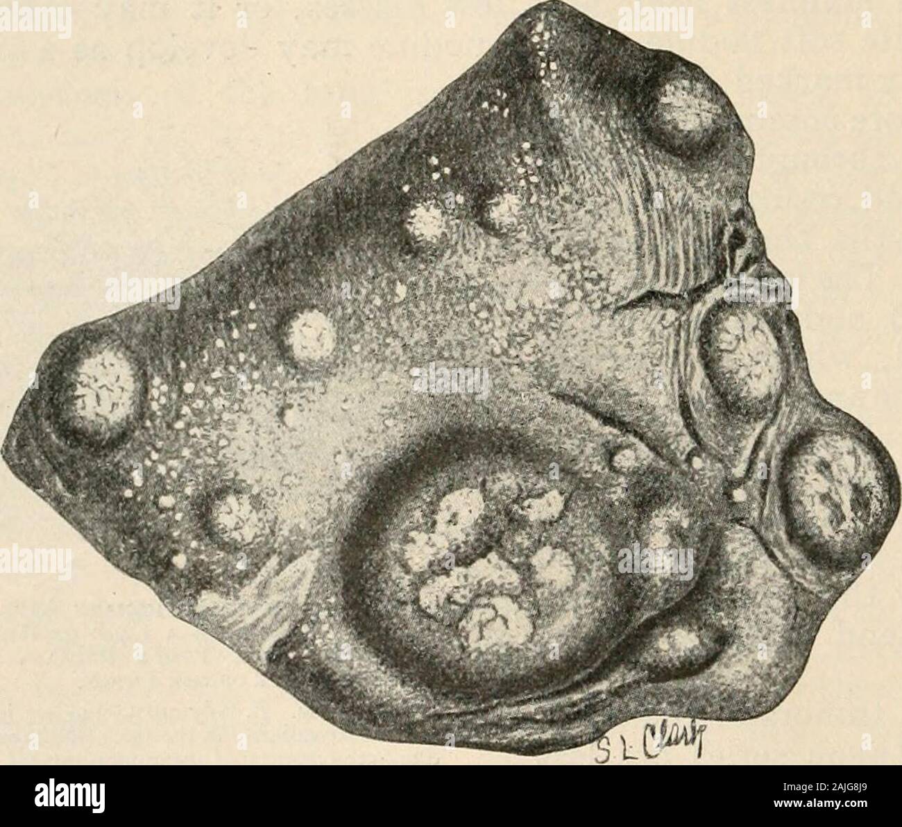 Manual of pathology : including bacteriology, the technic of ...