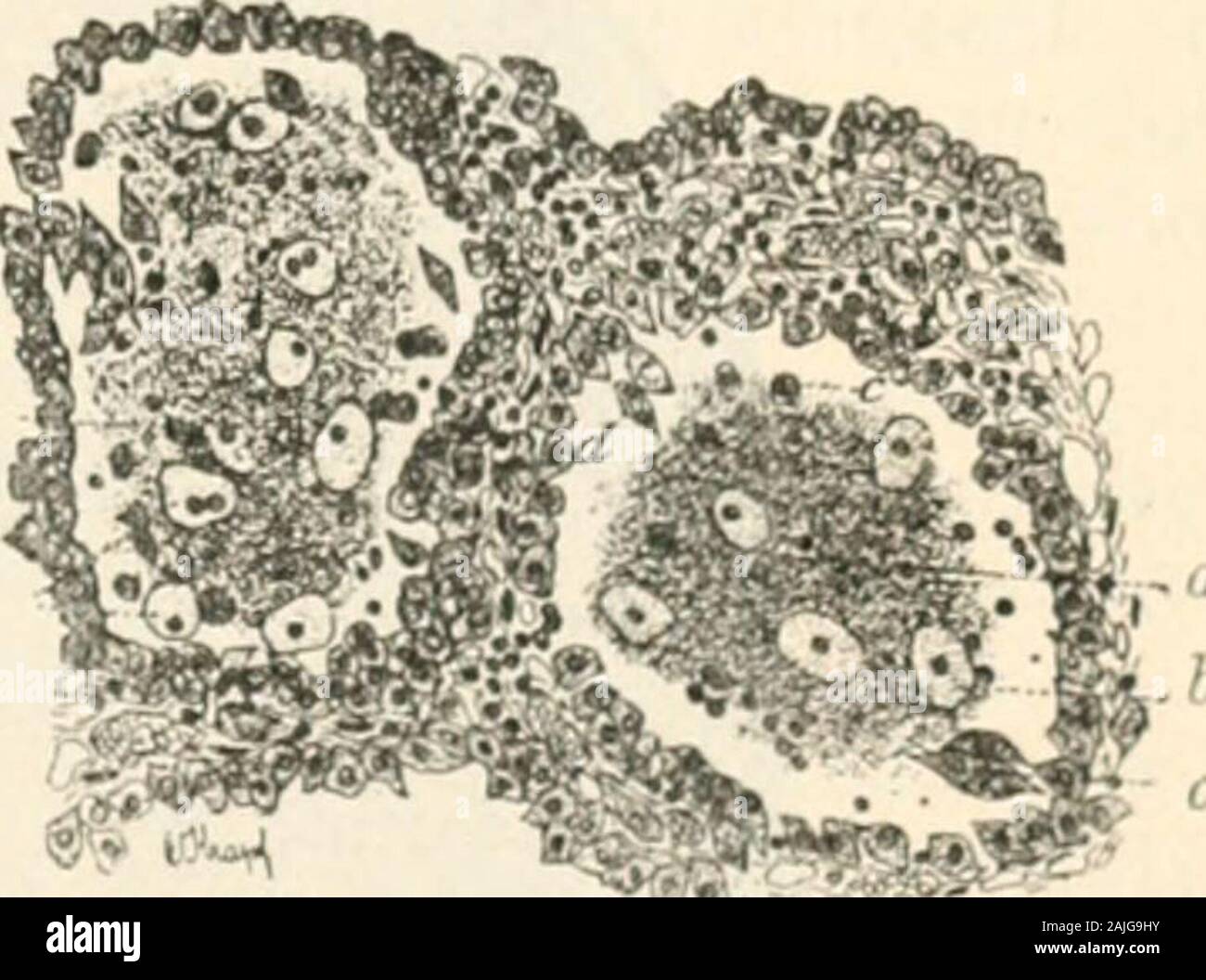 Manual of pathology : including bacteriology, the technic of ...
