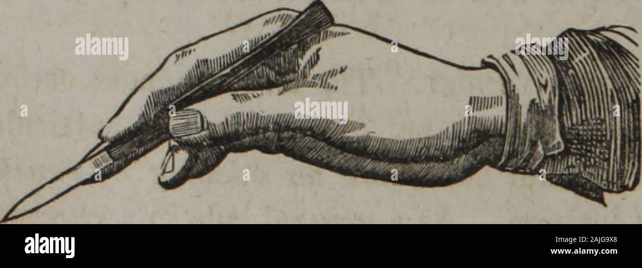 Anasarca hi-res stock photography and images - Alamy