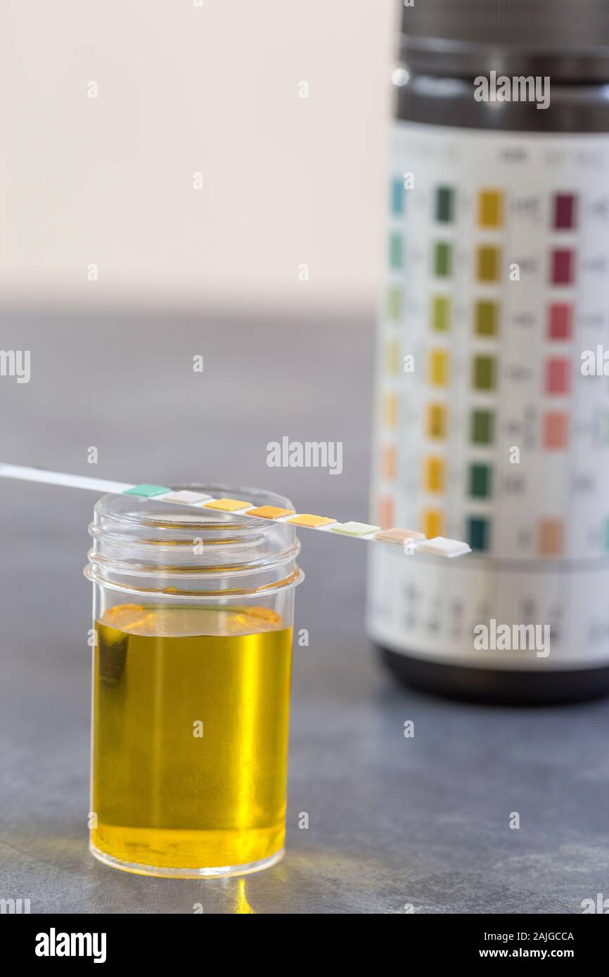 Strip of ph paper resting on specimen, with comparison chart box Stock ...