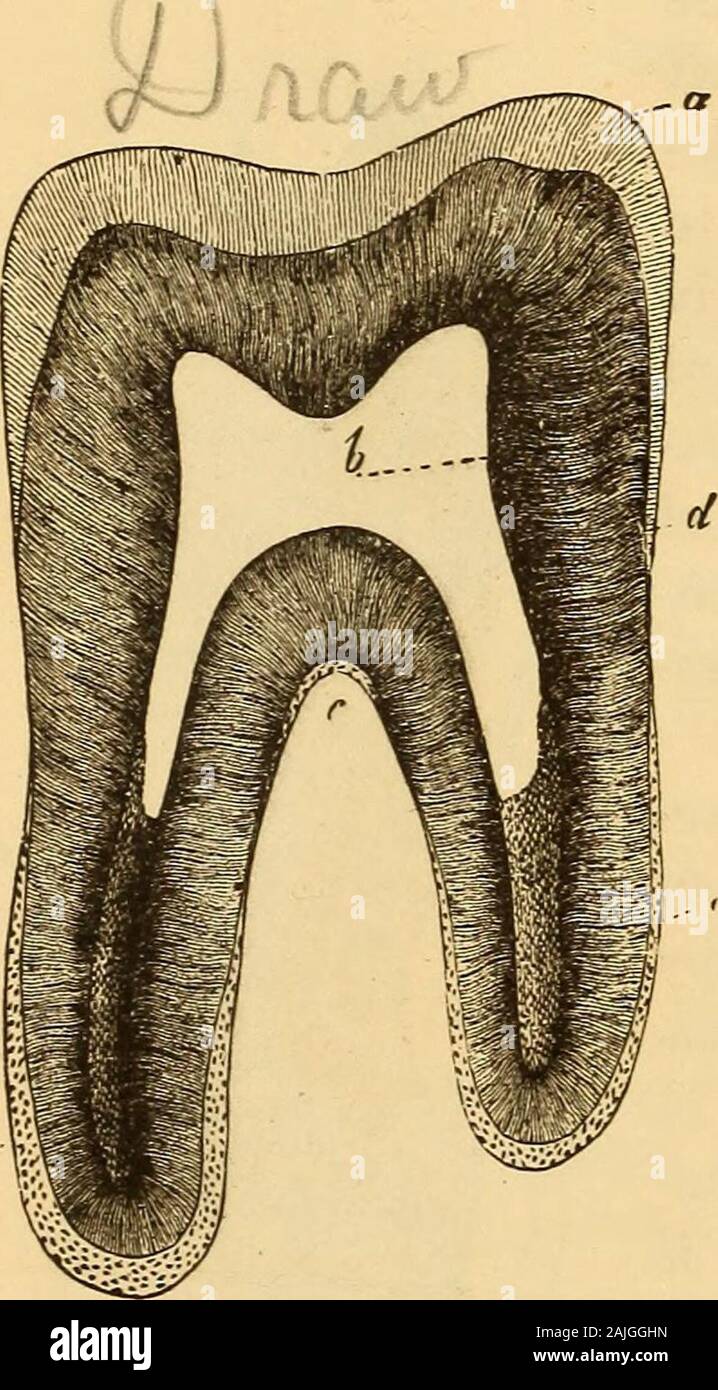 Milk teeth fall out hi-res stock photography and images - Alamy