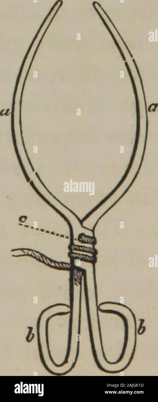 The principles and practice of obstetrics . acticable.It is the most ...