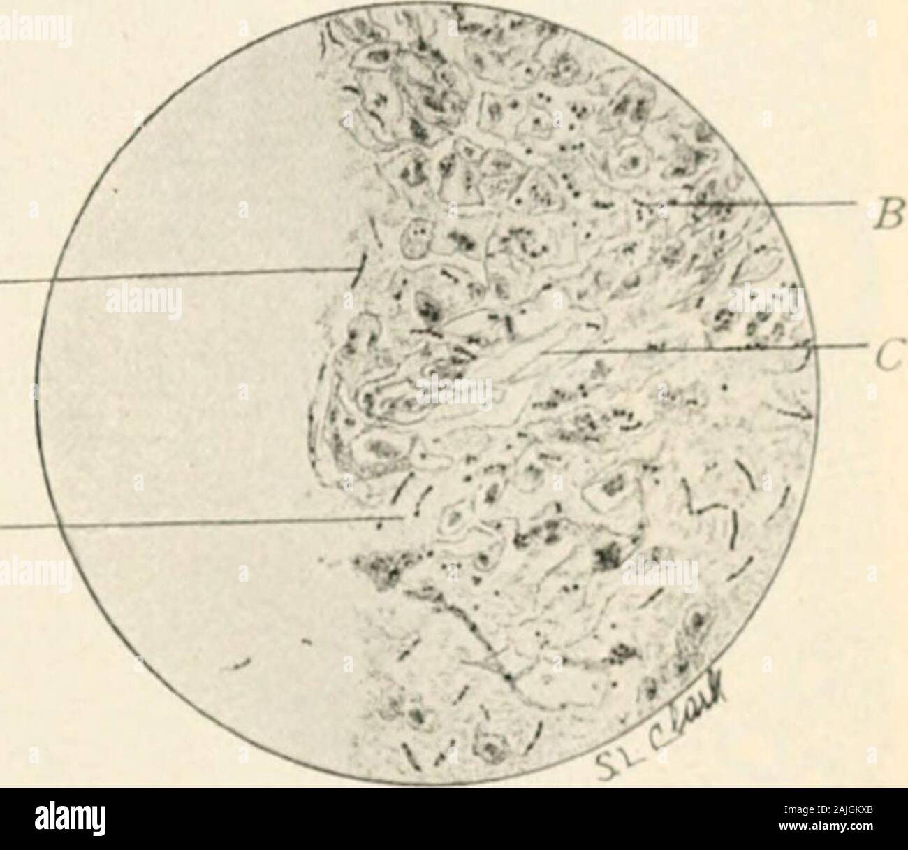 Manual of pathology : including bacteriology, the technic of ...
