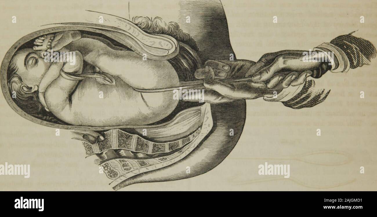 The principles and practice of obstetrics . he direction of the axis of ...