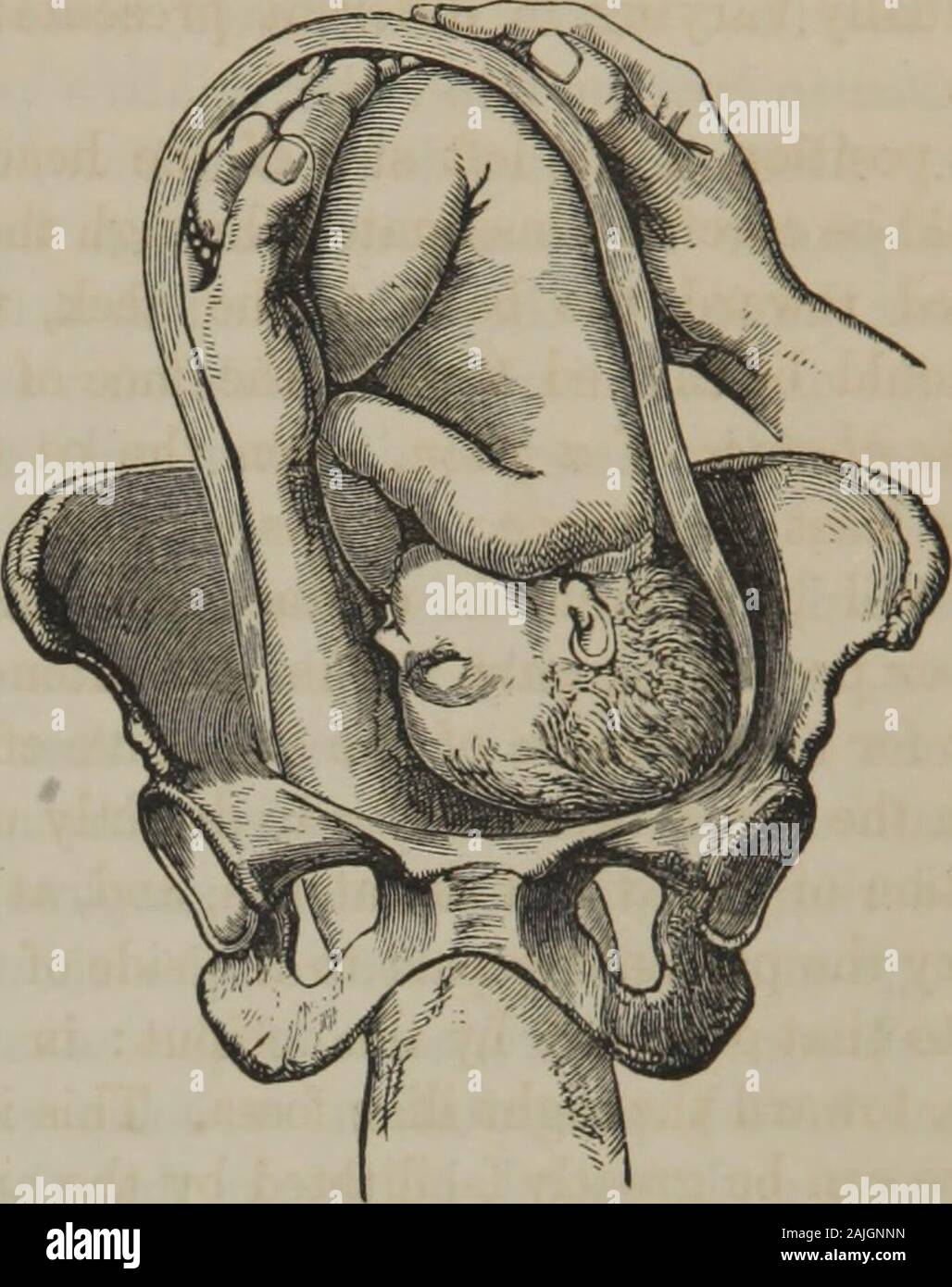 Iliac fossa hi-res stock photography and images - Alamy