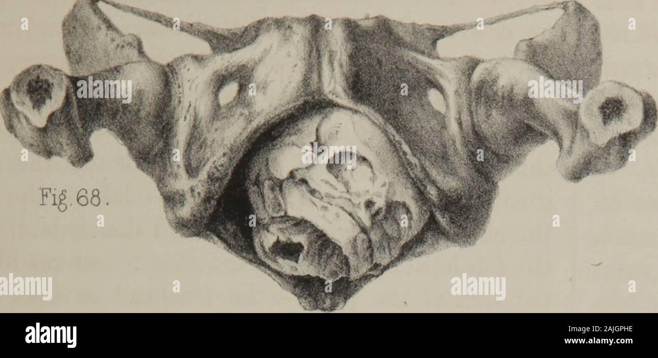 Occiput anterior hi-res stock photography and images - Alamy