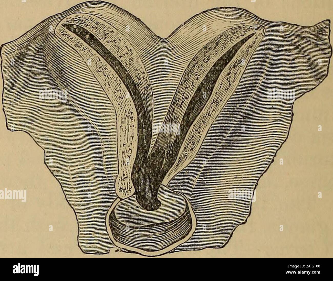 Double uterus hi-res stock photography and images - Alamy