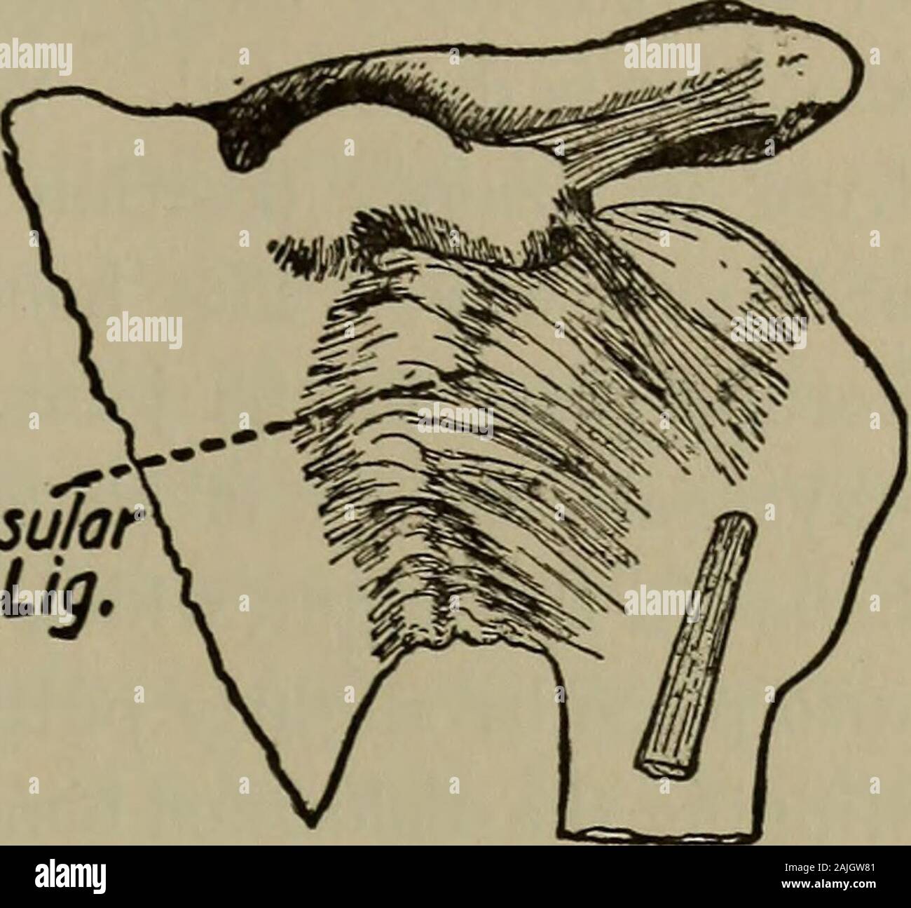 Shoulderblade bone hi-res stock photography and images - Alamy