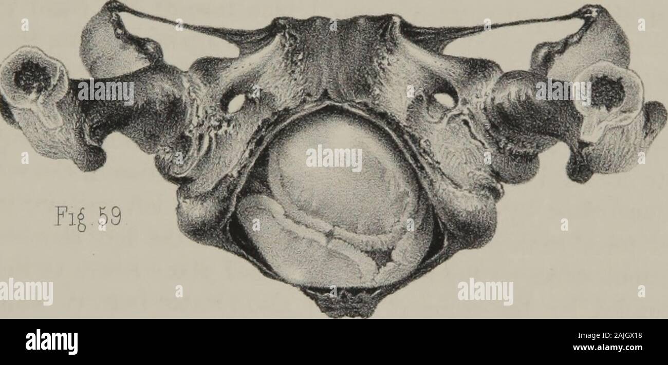 The principles and practice of obstetrics . 5 . position of Vertexat ...