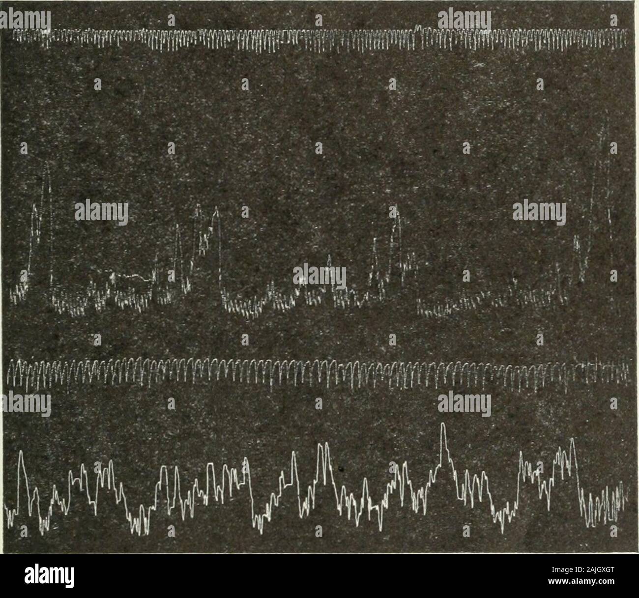 American journal of physiology . ger period are usually not accompanied ...