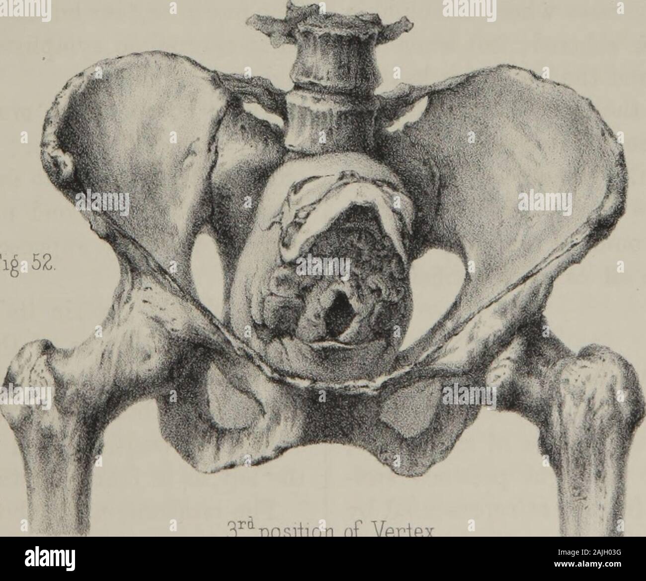 Occipito mental hi-res stock photography and images - Alamy