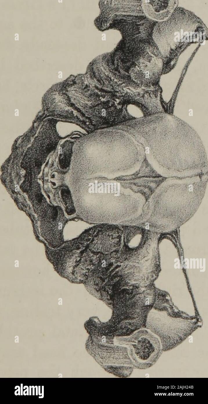 The principles and practice of obstetrics . p^ Stock Photo - Alamy