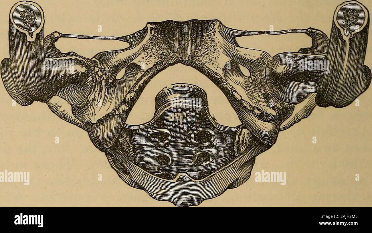 False pelvis hi-res stock photography and images - Alamy