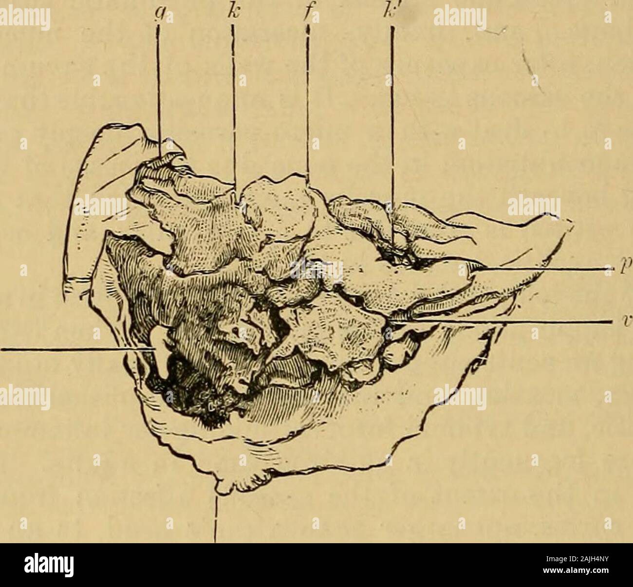 Zygomatic process hi-res stock photography and images - Alamy
