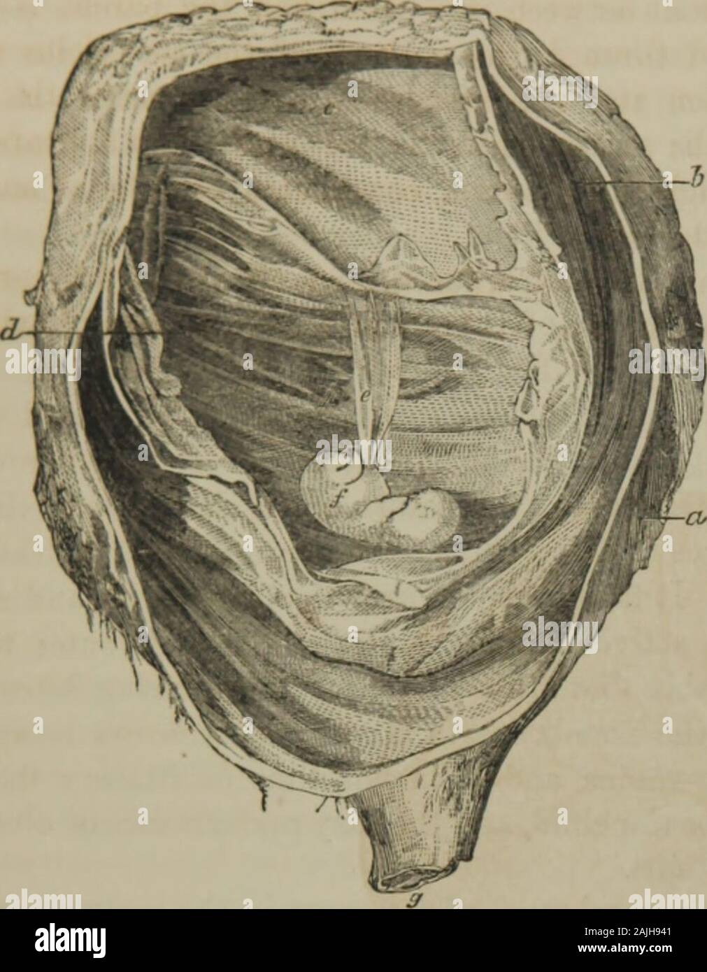 Membrana decidua hi-res stock photography and images - Alamy
