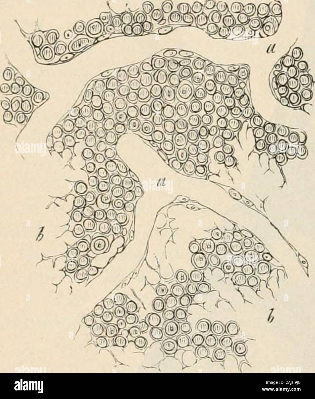 Bone osteosarcoma cells hi-res stock photography and images - Alamy
