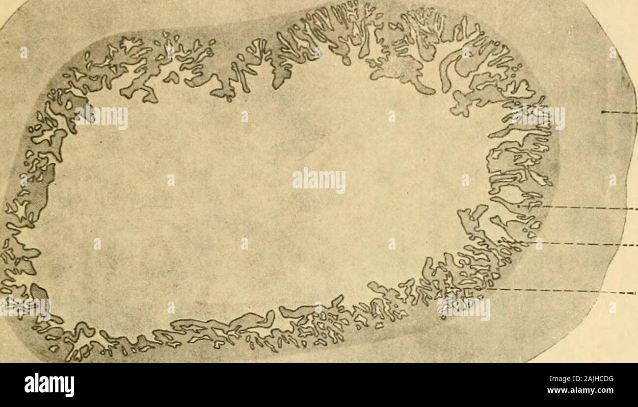 Vesiculae seminales hi-res stock photography and images - Alamy