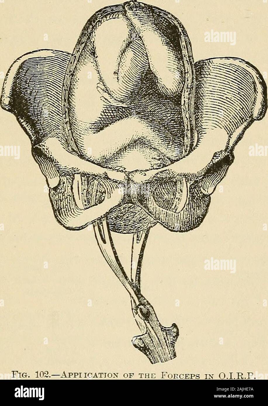 Occiput posterior hi-res stock photography and images - Alamy