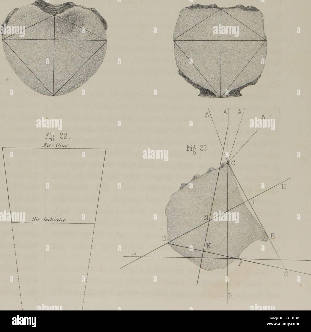 The principles and practice of obstetrics . Fig. 19. Fig. M.. T Suiclan ...
