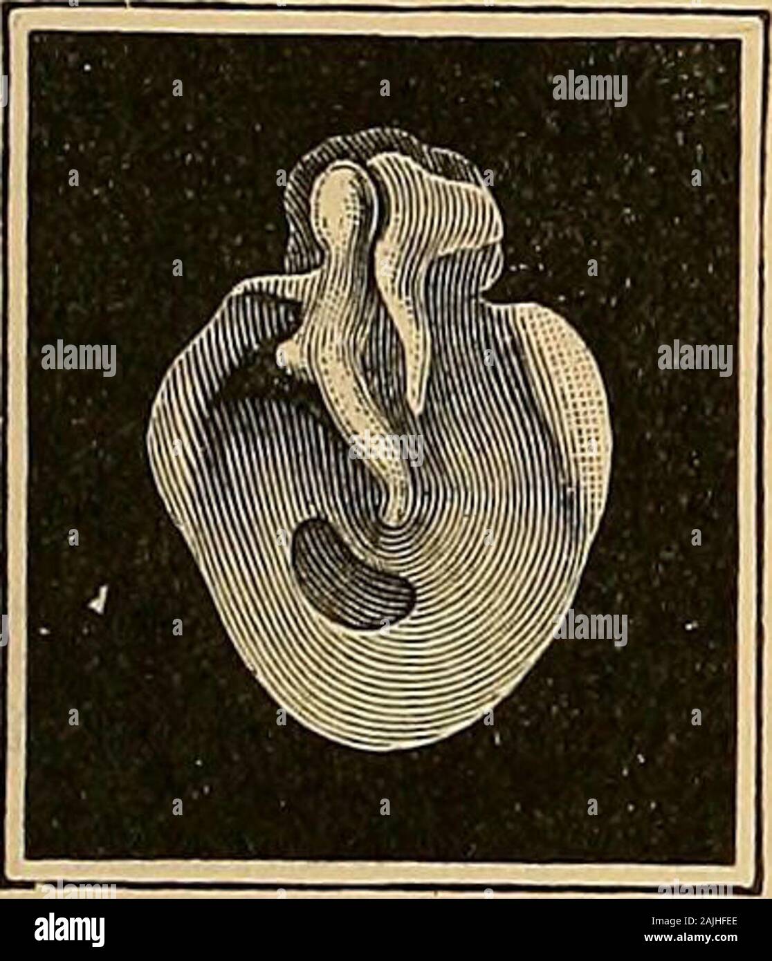 Auditory defect hi-res stock photography and images - Alamy