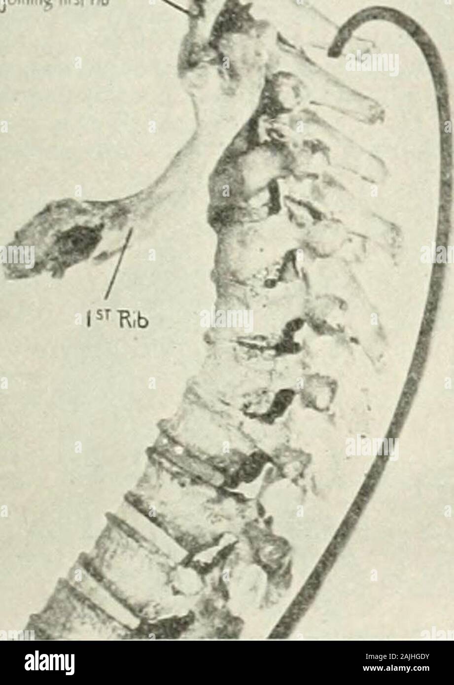 A reference handbook of the medical sciences, embracing the entire ...