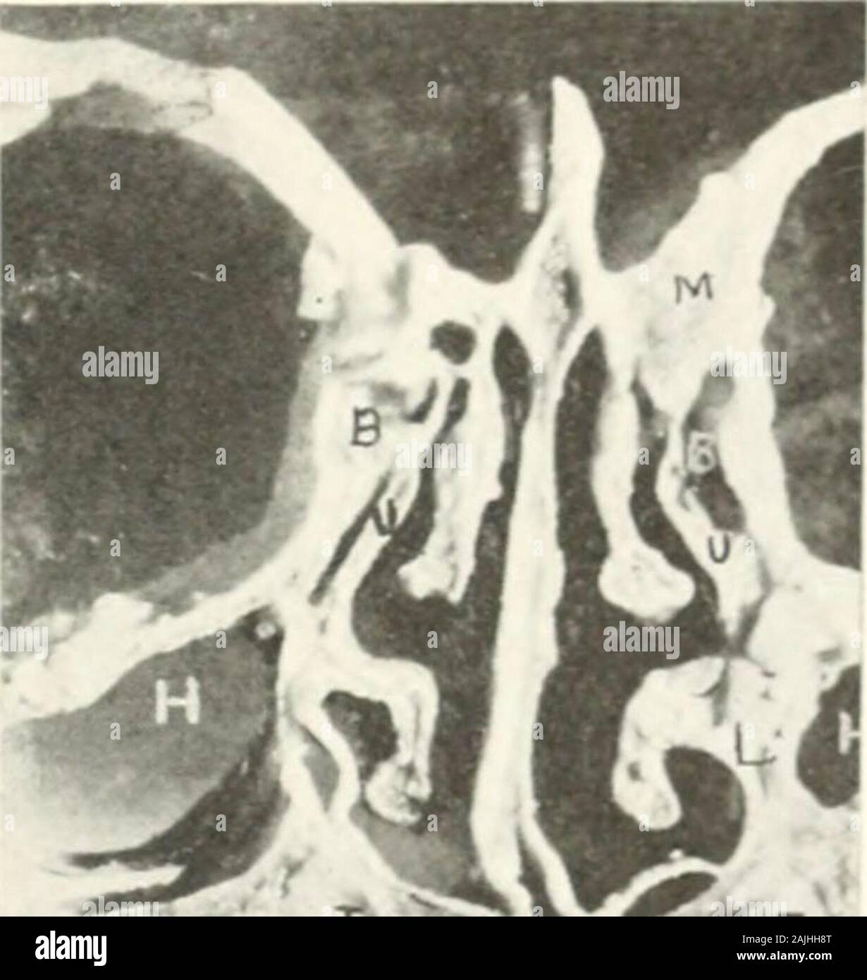 Uncinate process hi-res stock photography and images - Alamy