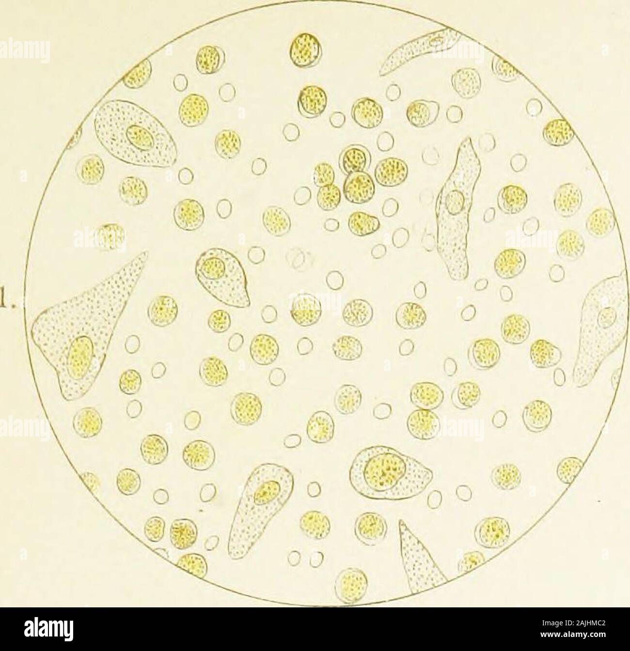 Atlas of urinary sediments; with special reference to their clinical ...