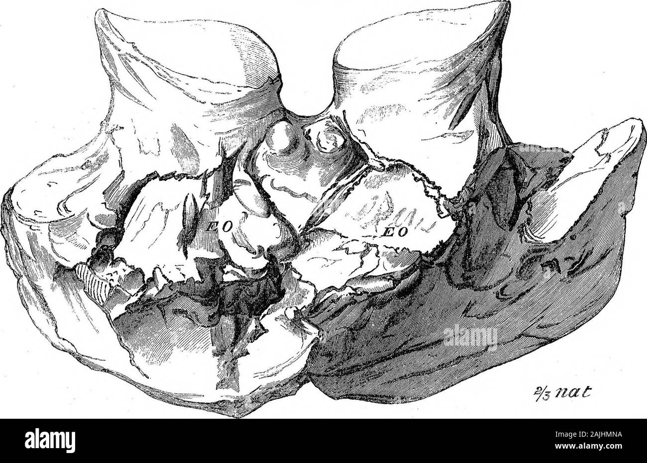 Vii vertebra hi-res stock photography and images - Alamy