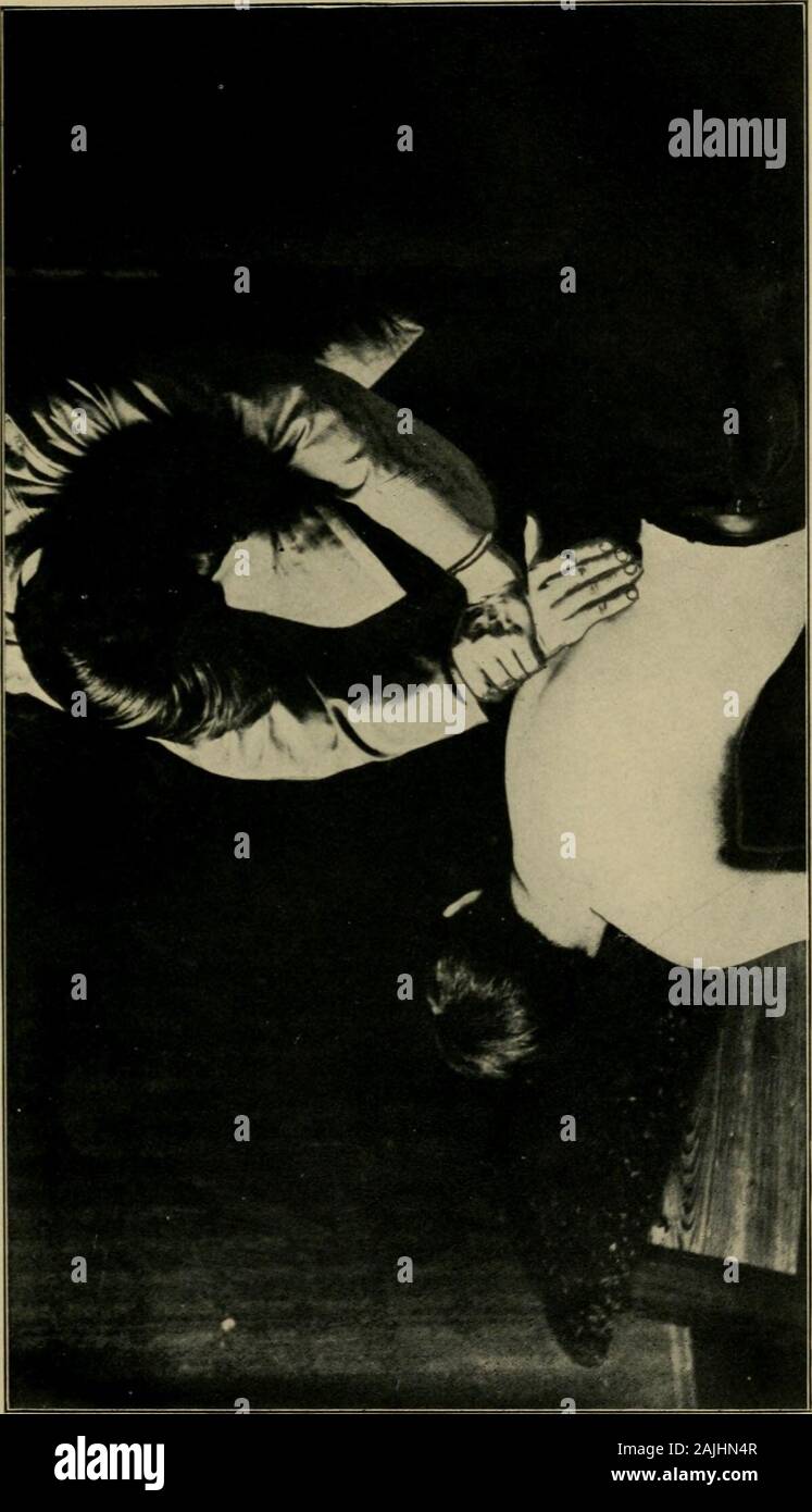 Technic and practice of chiropractic . st spinous, fingers rigid and ...