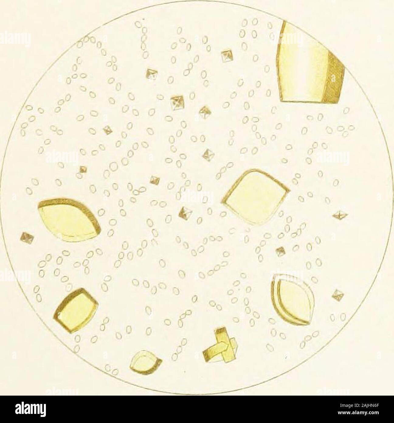 Atlas of urinary sediments; with special reference to their clinical ...