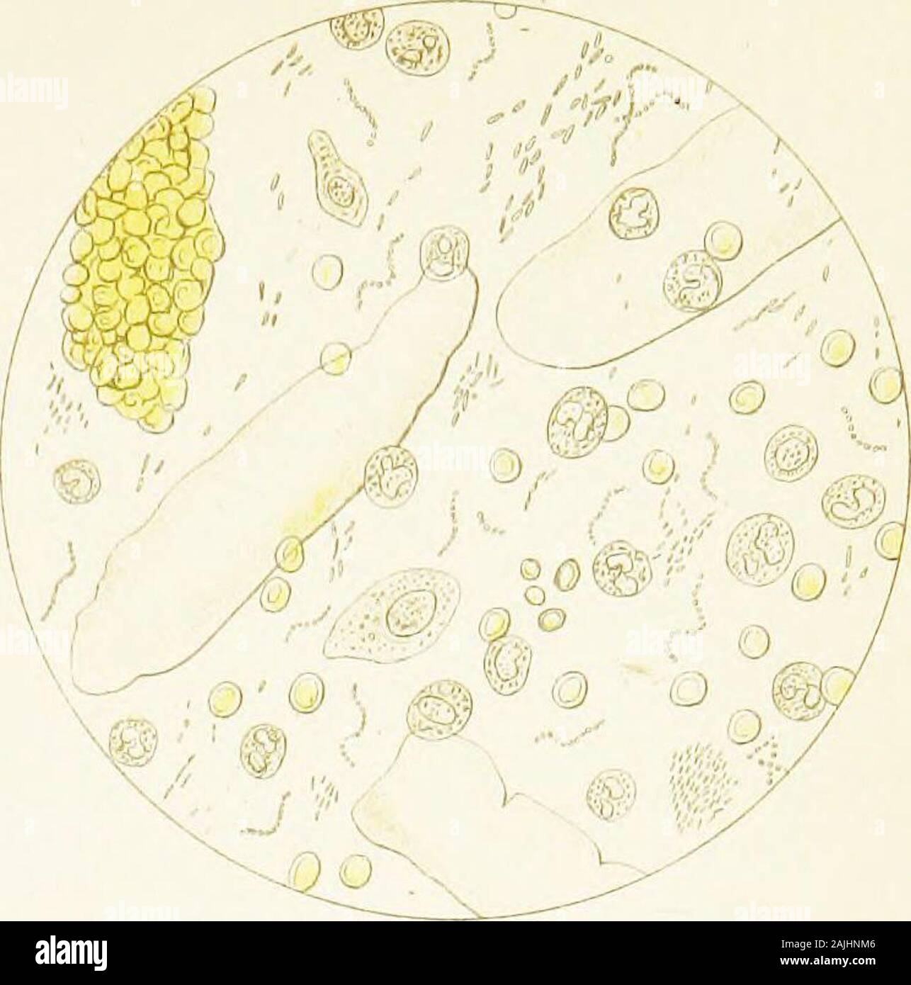 Atlas of urinary sediments; with special reference to their clinical ...
