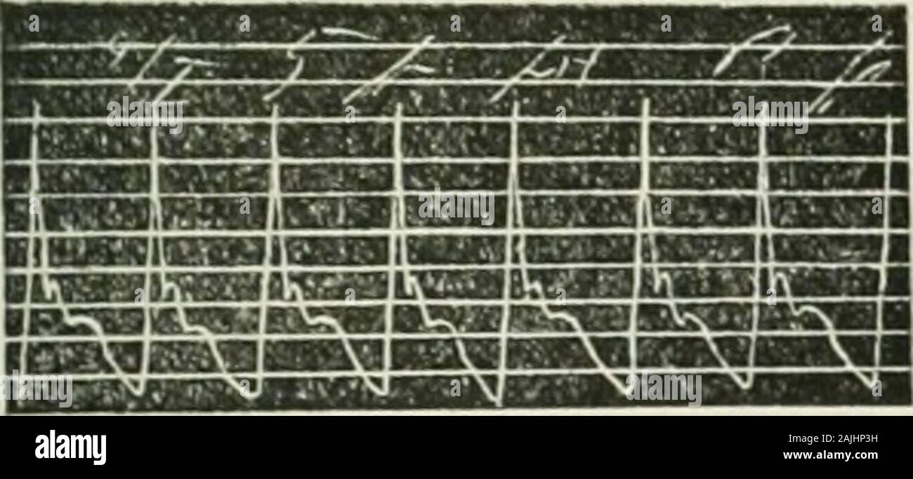 Jugulum hi-res stock photography and images - Alamy