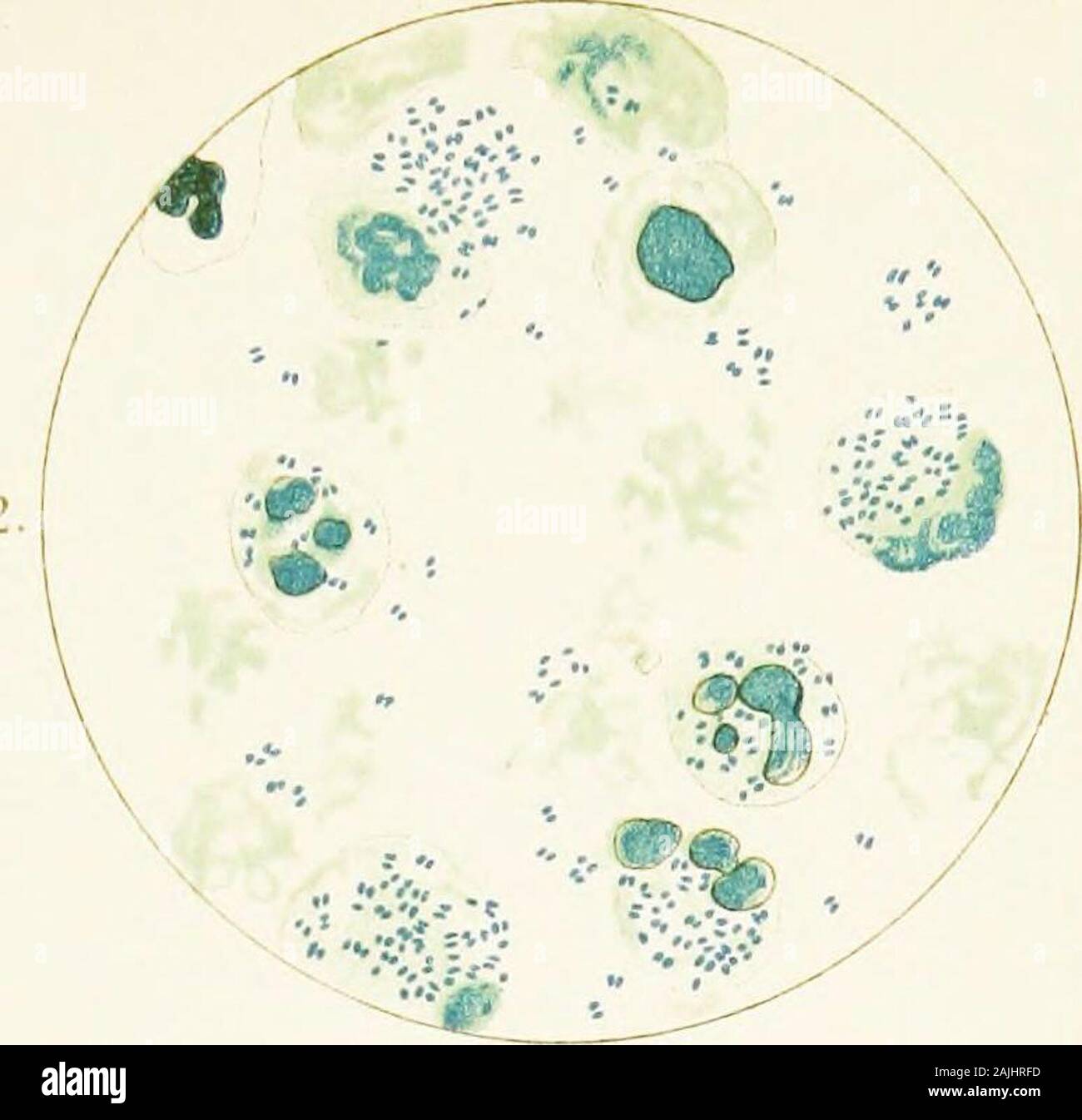 Atlas of urinary sediments; with special reference to their clinical ...