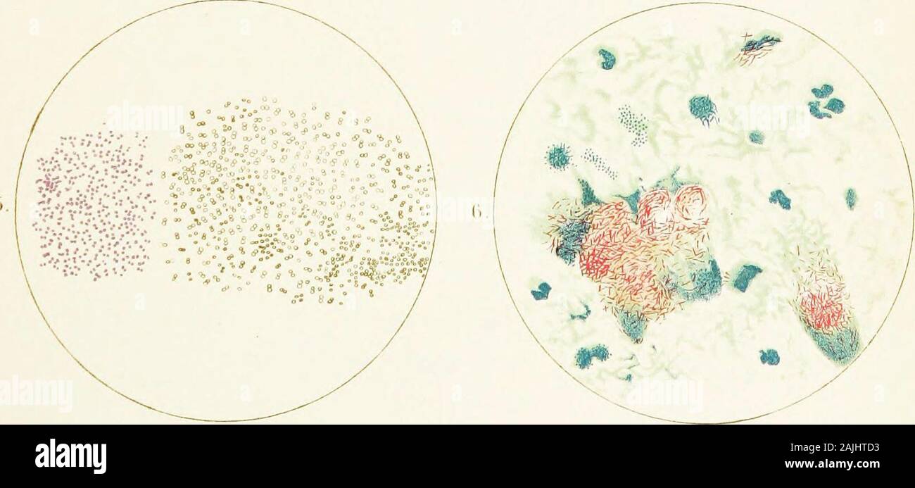 Atlas of urinary sediments; with special reference to their clinical ...