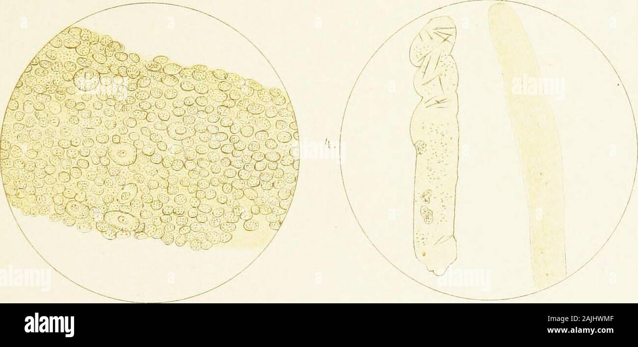 Atlas of urinary sediments; with special reference to their clinical ...
