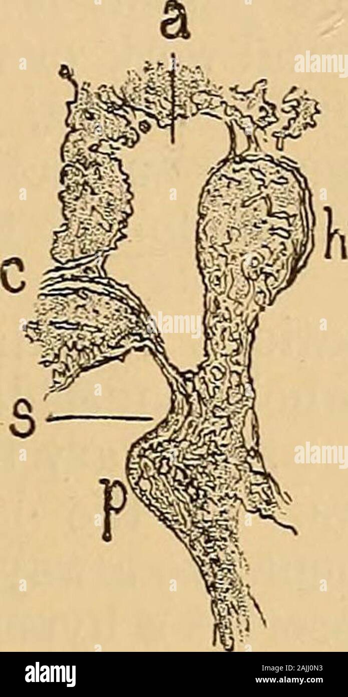 Cavum tympani hi-res stock photography and images - Alamy