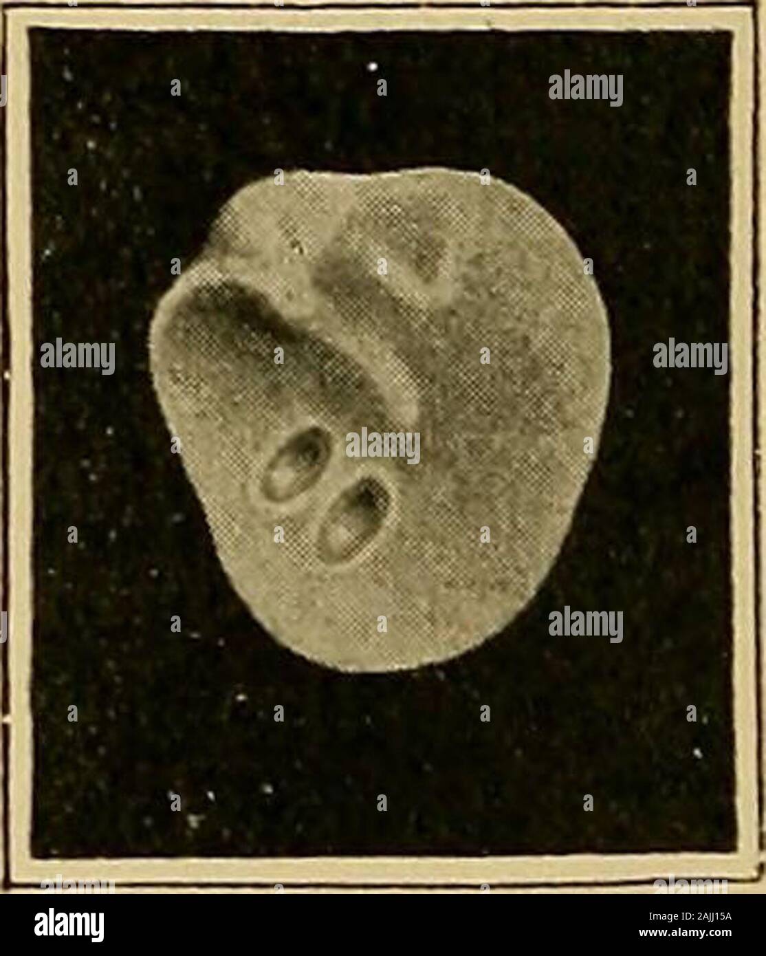 Scrofulous hi-res stock photography and images - Alamy