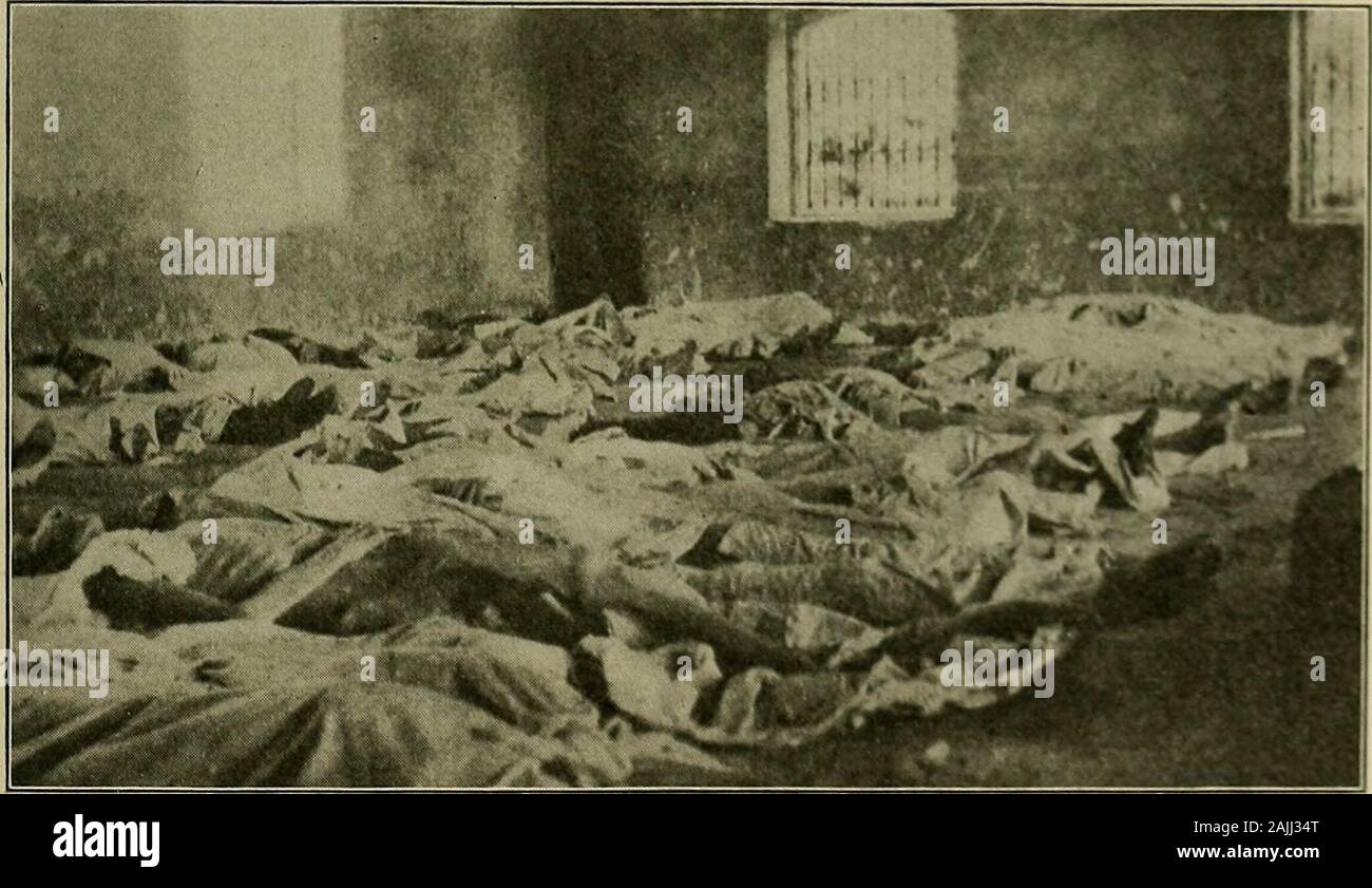 Typhus fever : with particular reference to the Serbian epidemic. . Fig ...