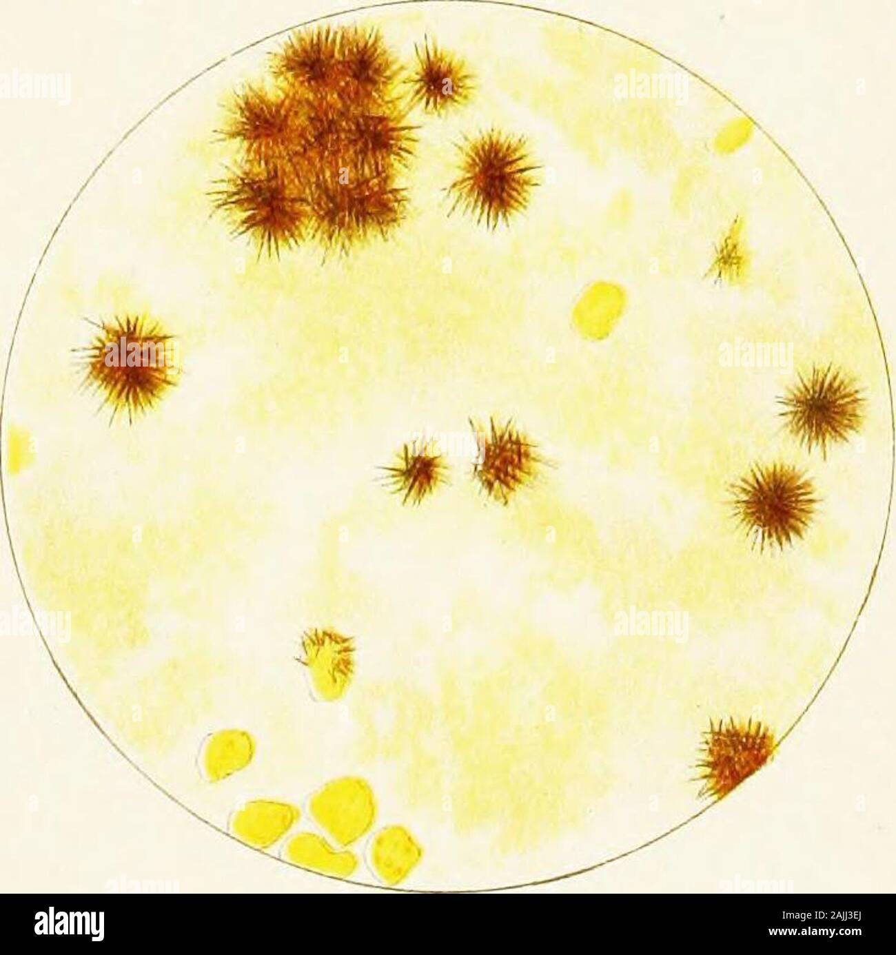 Atlas of urinary sediments; with special reference to their clinical ...