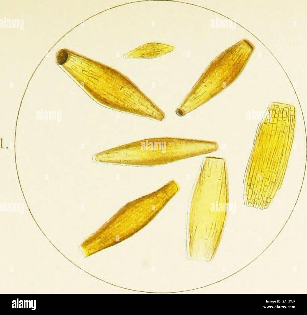 Bilirubin Crystal In Urine