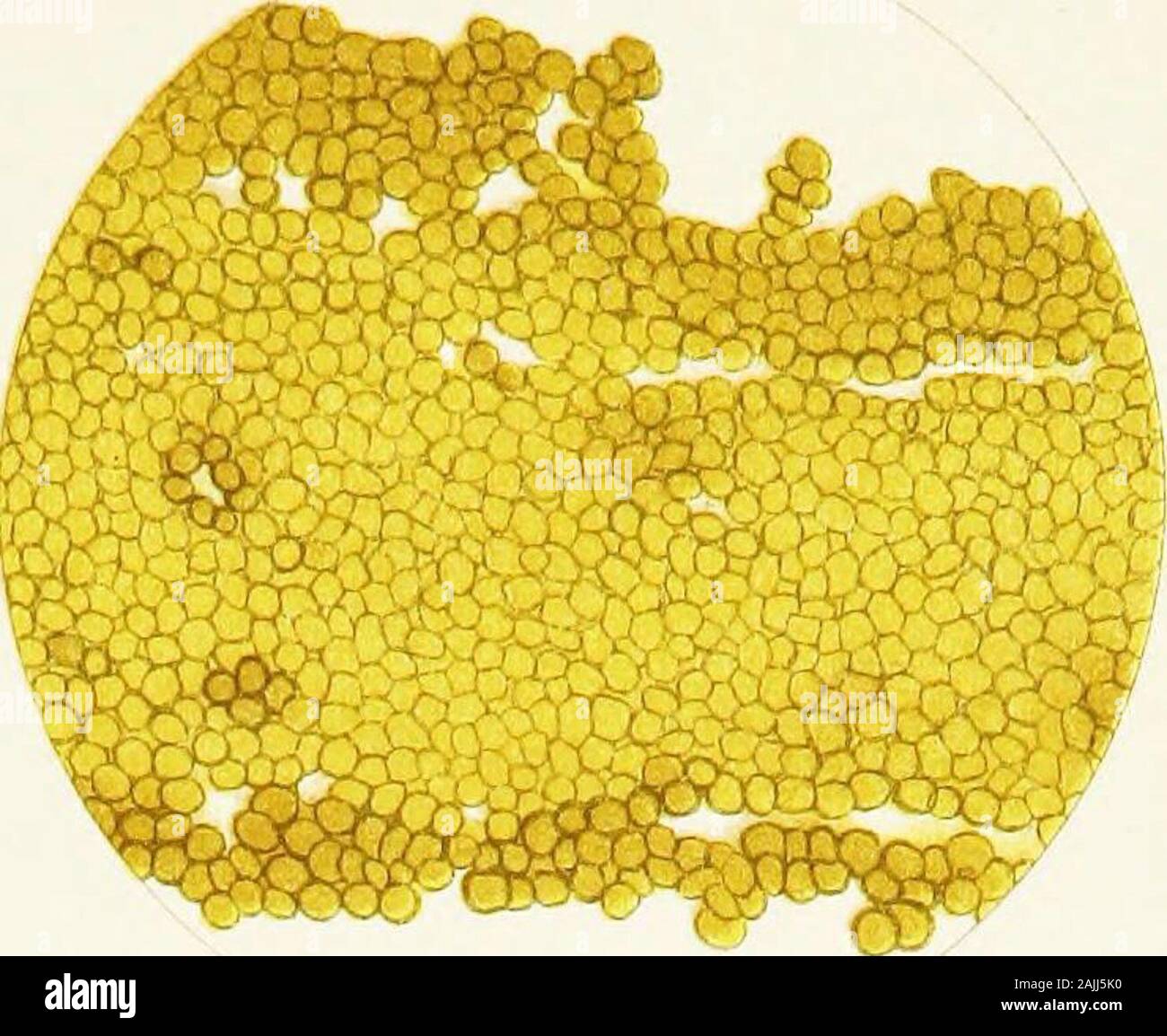 Atlas of urinary sediments; with special reference to their clinical ...