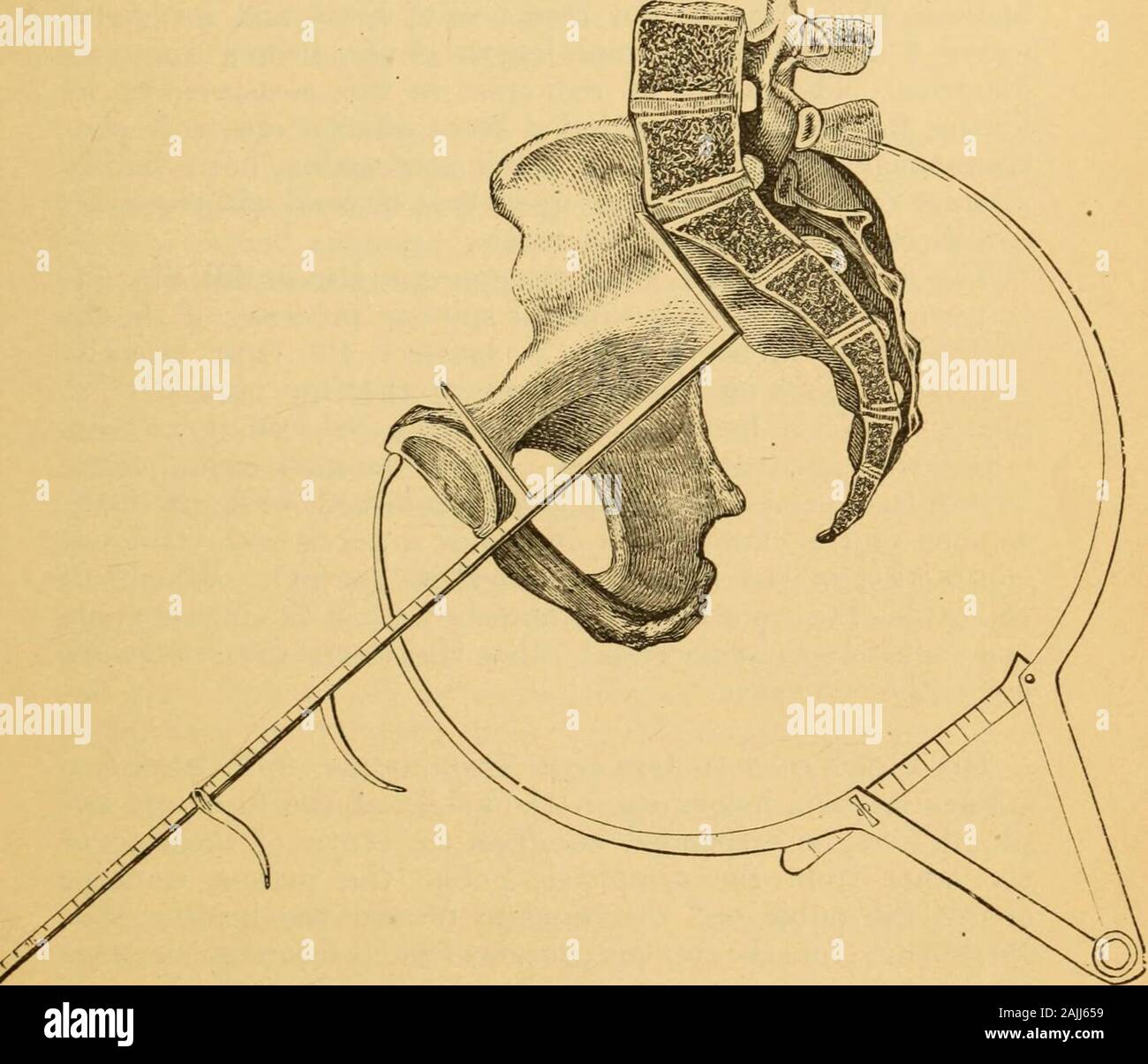 Pelvimetry hi-res stock photography and images - Alamy