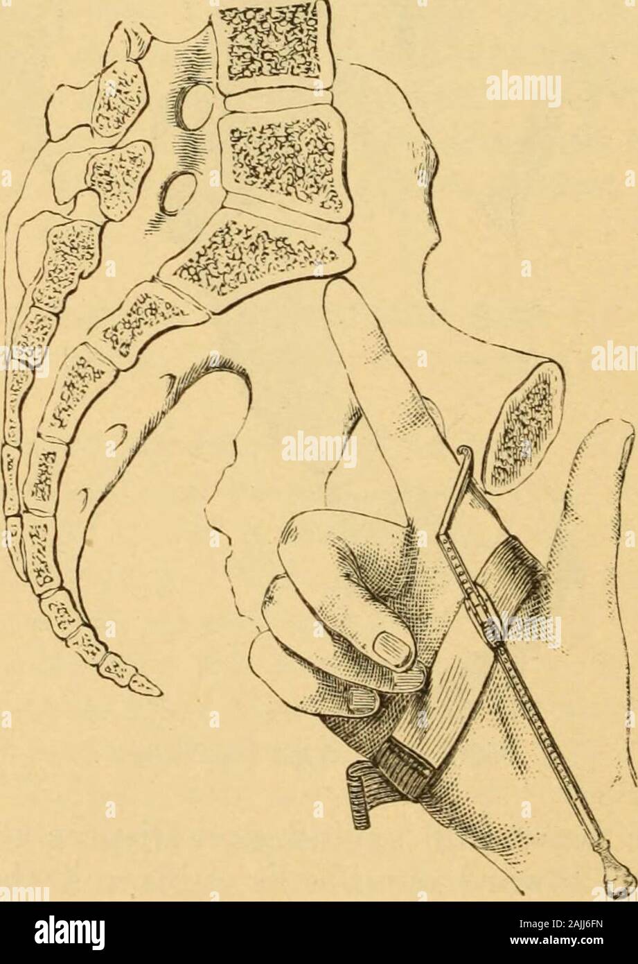 A manual of practical obstetrics . Lumley Earles pelvimeter.Fro. 129 ...