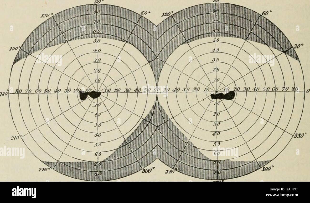 Scotoma hi-res stock photography and images - Alamy