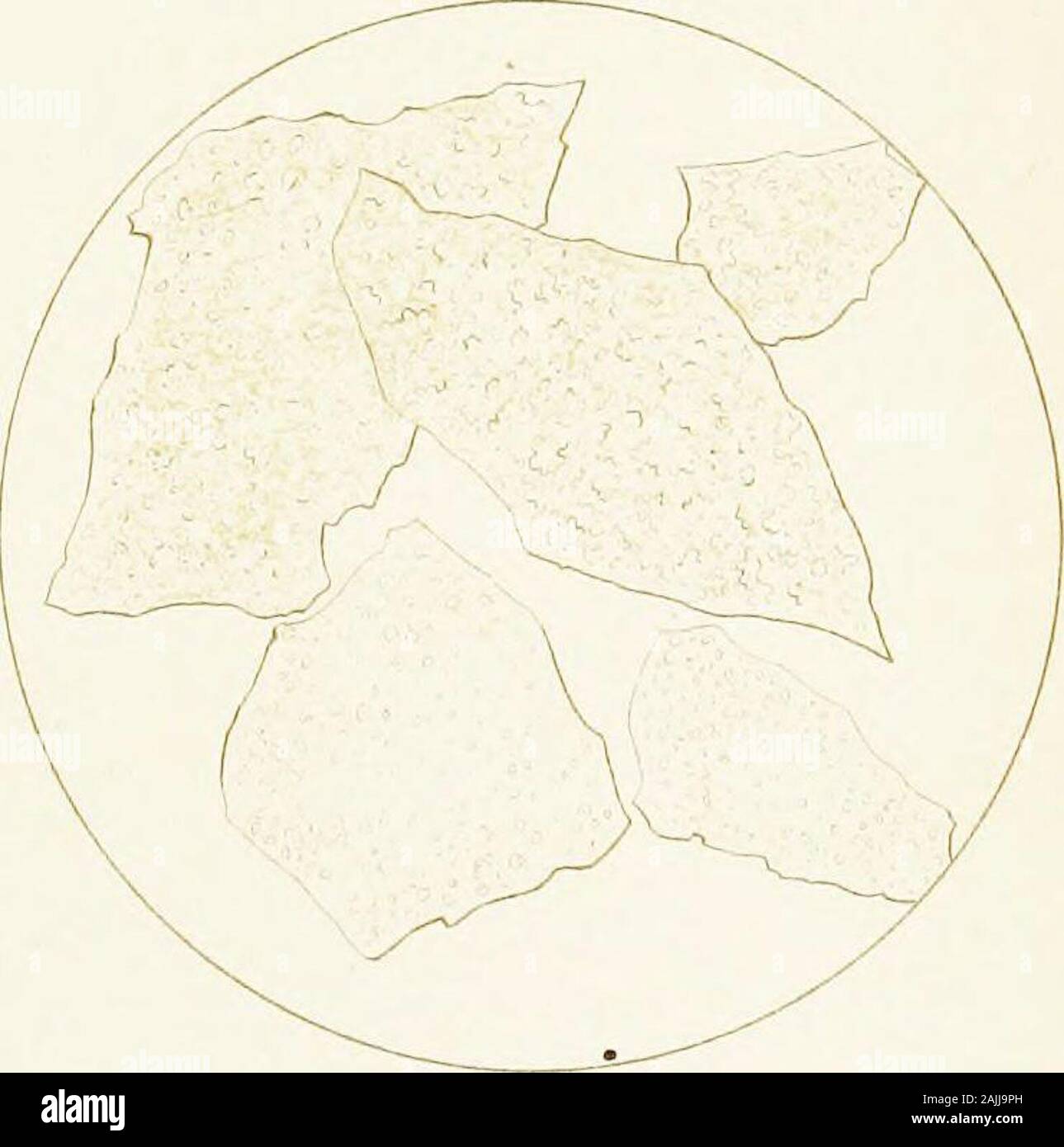 Atlas of urinary sediments; with special reference to their clinical ...